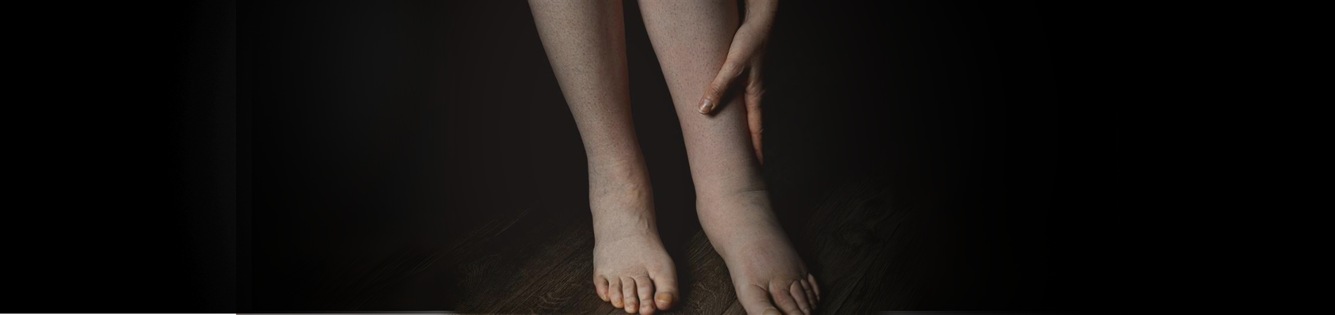 CVI & DVT Guide: Causes, Symptoms, Treatments & Prevention